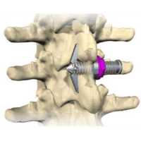 Minuteman® - Essential Sports & Spine Solutions