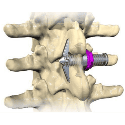 Minuteman® - Essential Sports & Spine Solutions
