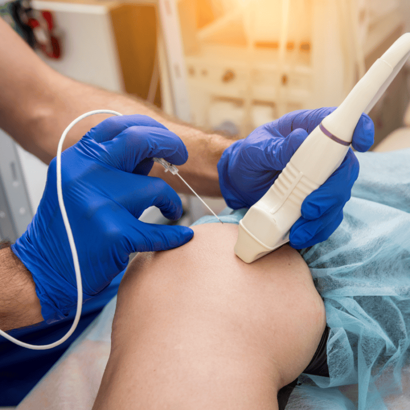 Radiofrequency Ablation Ohio Pain Management Specialist