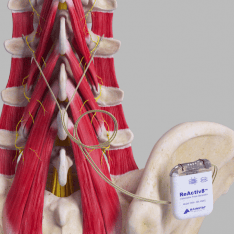 ReActiv8® - Essential Sports & Spine Solutions