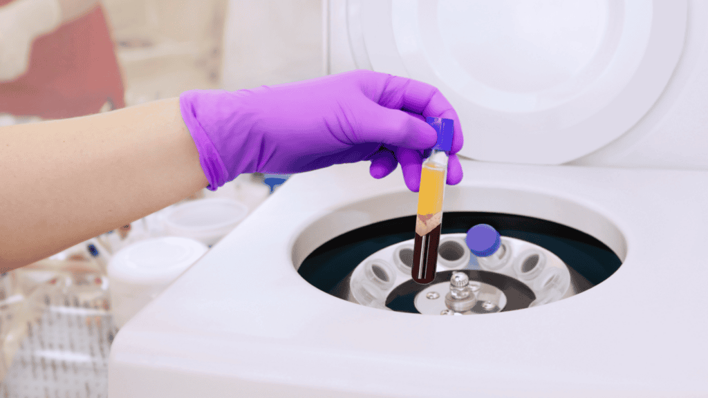PRP Back Injections: A Breakthrough for Chronic Back Pain - Essential ...
